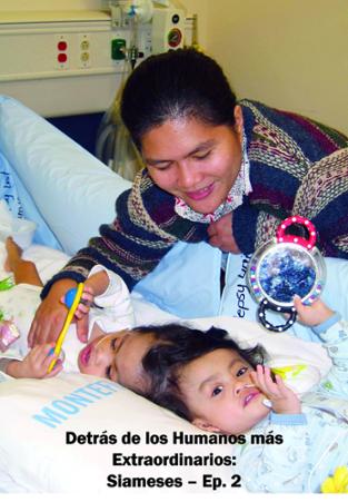 Detrás de los humanos más extraordinarios: Siameses- EP.2